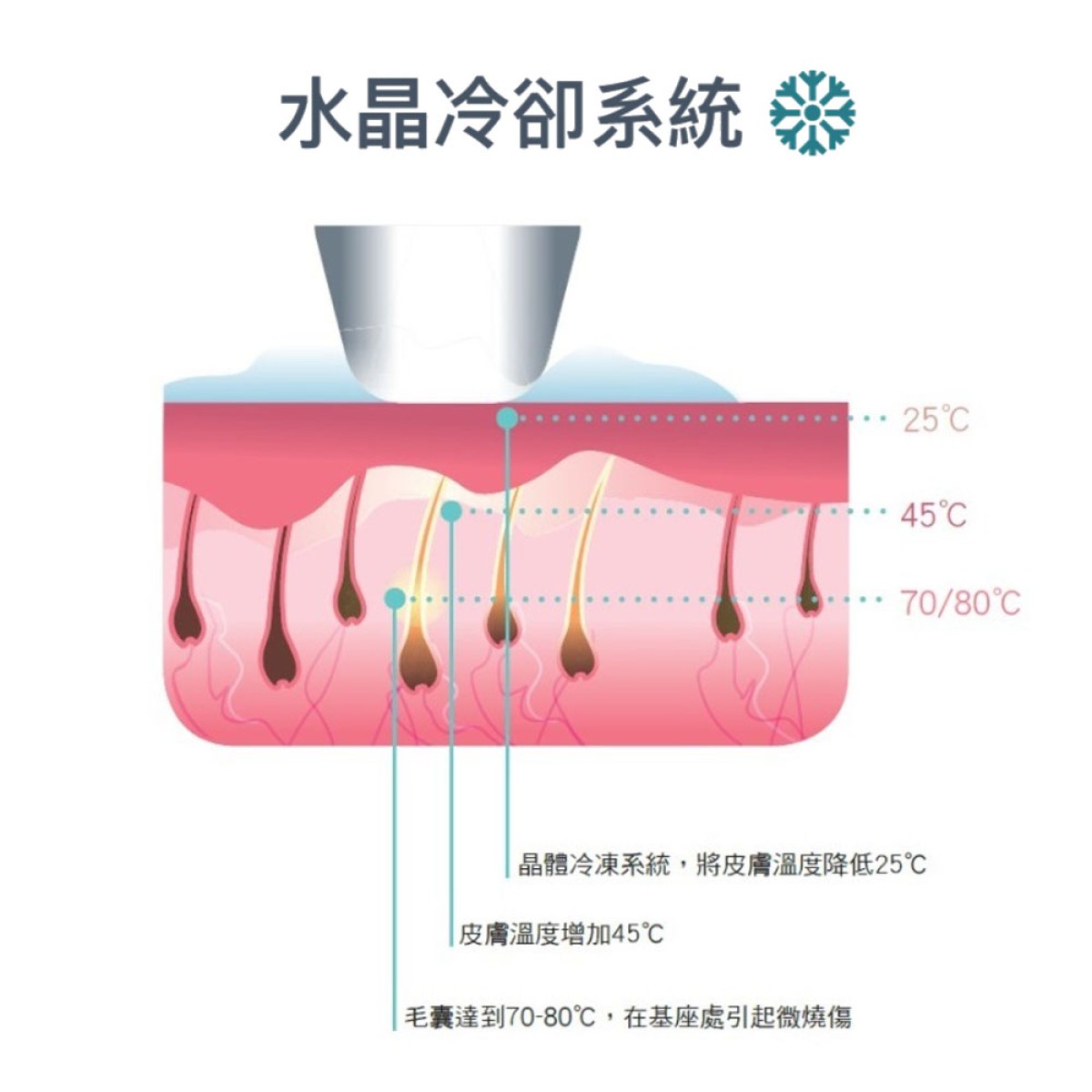 Elysion-pro 3 激光冰感脫毛